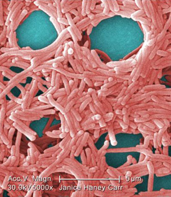 Opportunistic Pathogens (OPs): #1 cause of waterborne diseases in the ...